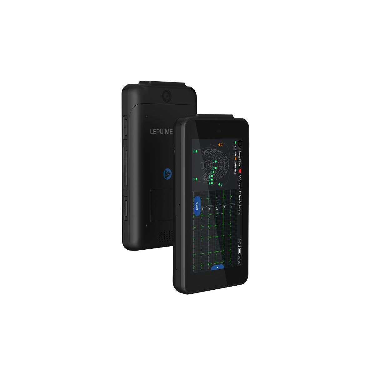 Électrocardiographe de poche PCECG-500 | FRAFITO