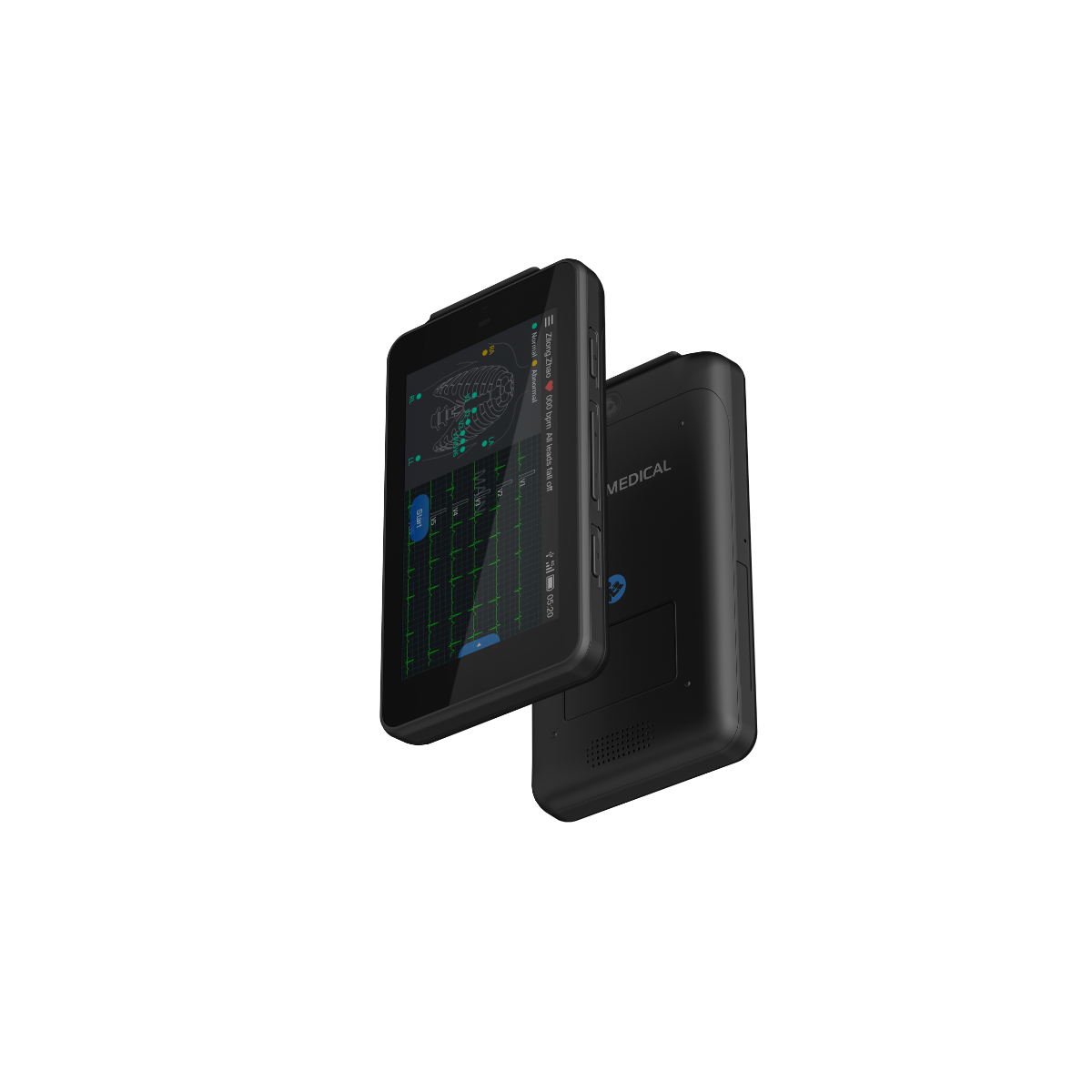 Électrocardiographe de poche PCECG-500 | FRAFITO