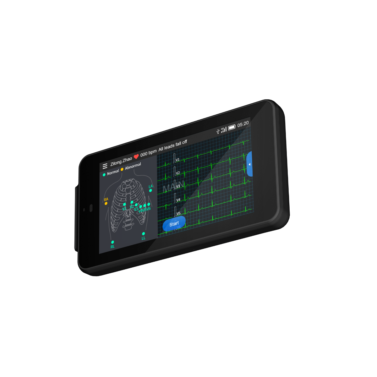 Électrocardiographe de poche PCECG-500 | FRAFITO